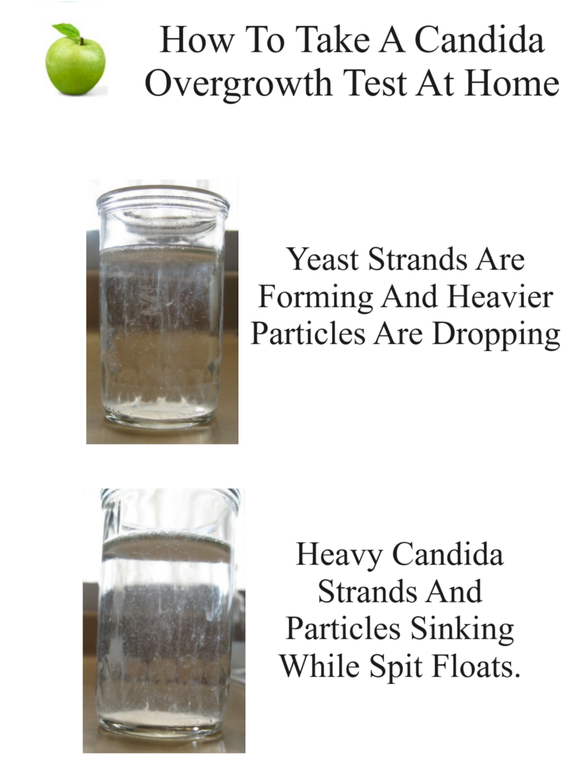 A Simple Candida Overgrowth Test You Can Do Yourself at Home.